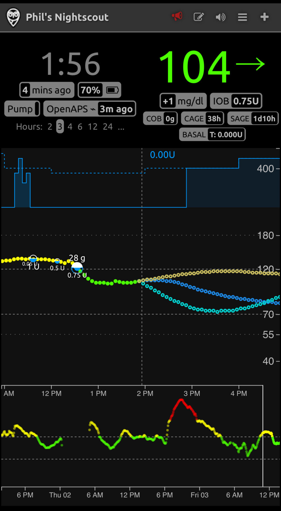 LoopFollow | Loop and Learn